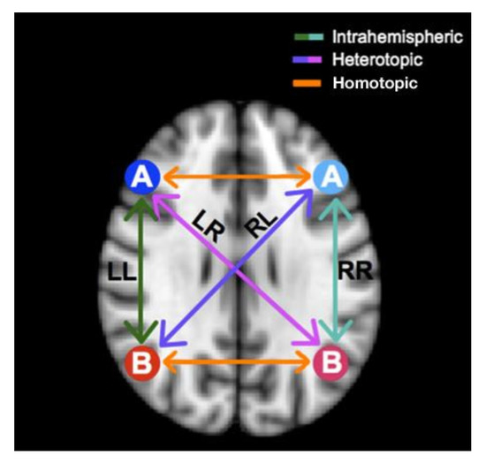 A Model for Diagnosing Autism Patients Using Spatial and Statistical ...