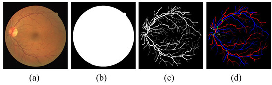 Diagnostics | Free Full-Text | End-to-End Automatic Classification of Retinal Vessel Based on ...