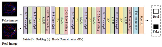 End-to-End Automatic Classification of Retinal Vessel Based on ...