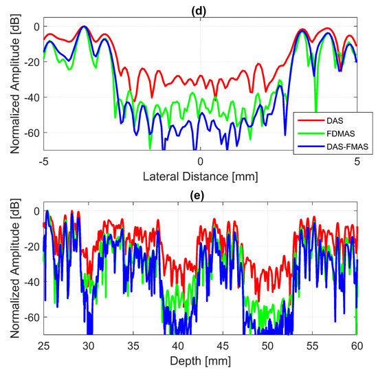 Enhancement of Ultrasound B-Mode Image Quality Using Nonlinear Filtered ...