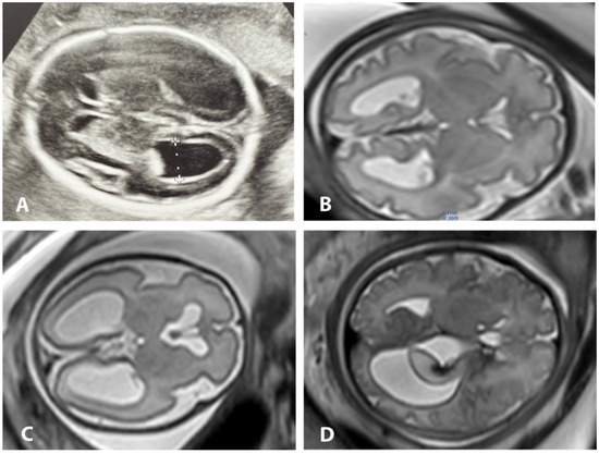 Diagnostics | Free Full-Text | Concordance between US and MRI Two ...