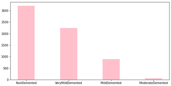 Accurate Detection of Alzheimer’s Disease Using Lightweight Deep ...