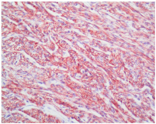 Diagnostics | Free Full-Text | Voltage-Dependent Anion Channel 1 ...