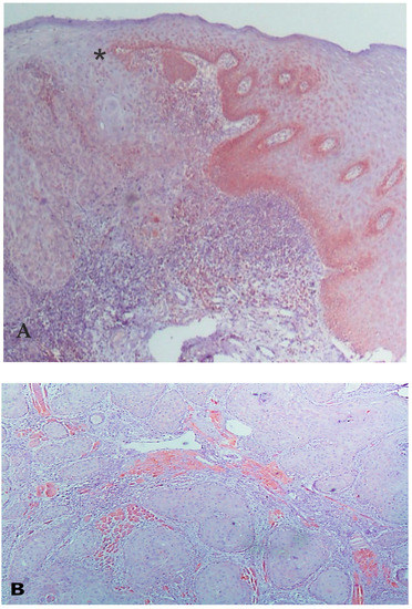 Diagnostics | Free Full-Text | Voltage-Dependent Anion Channel 1 ...