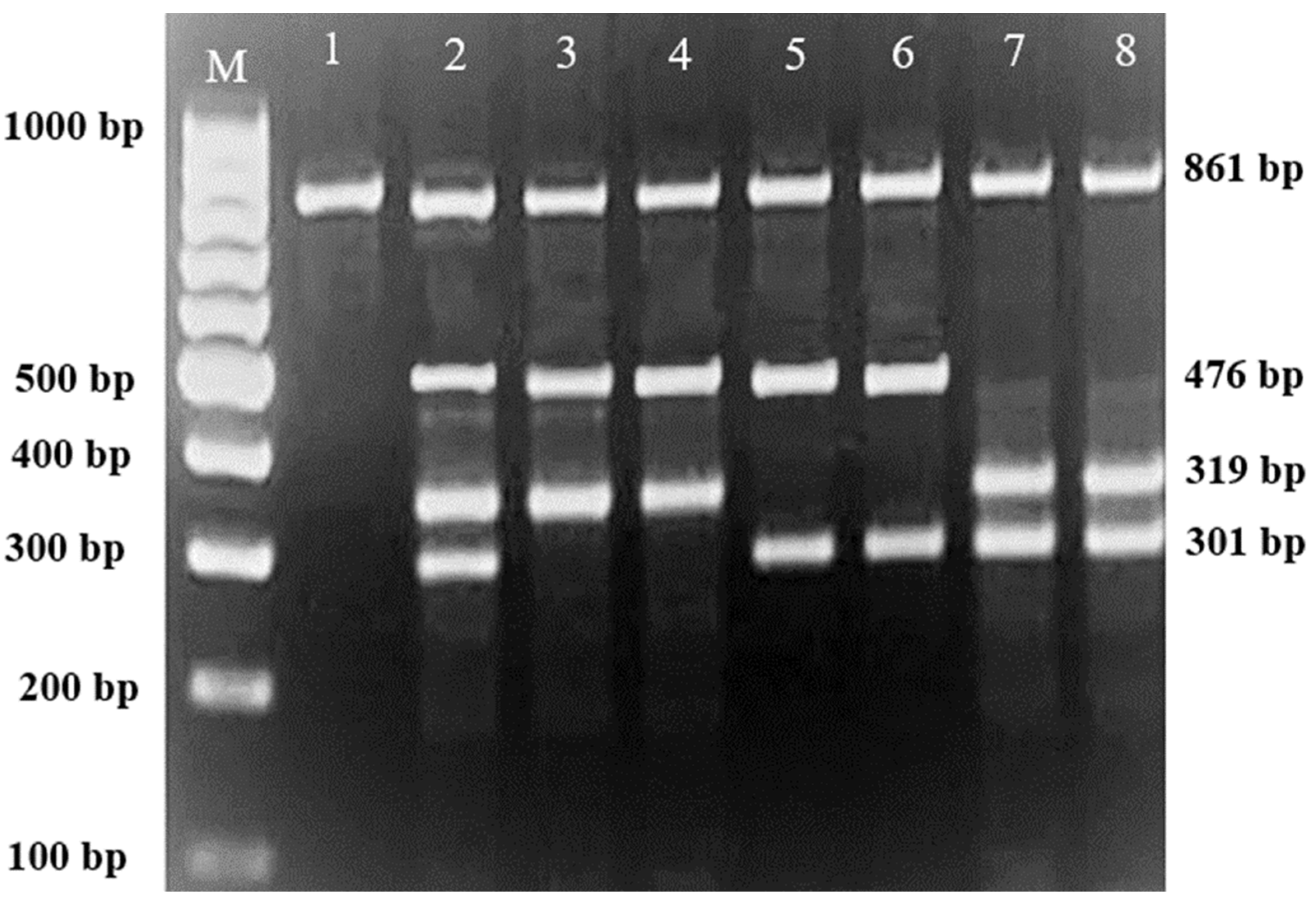 HBB Gene Mutations and Their Pathological Impacts on HbE/β-Thalassaemia ...