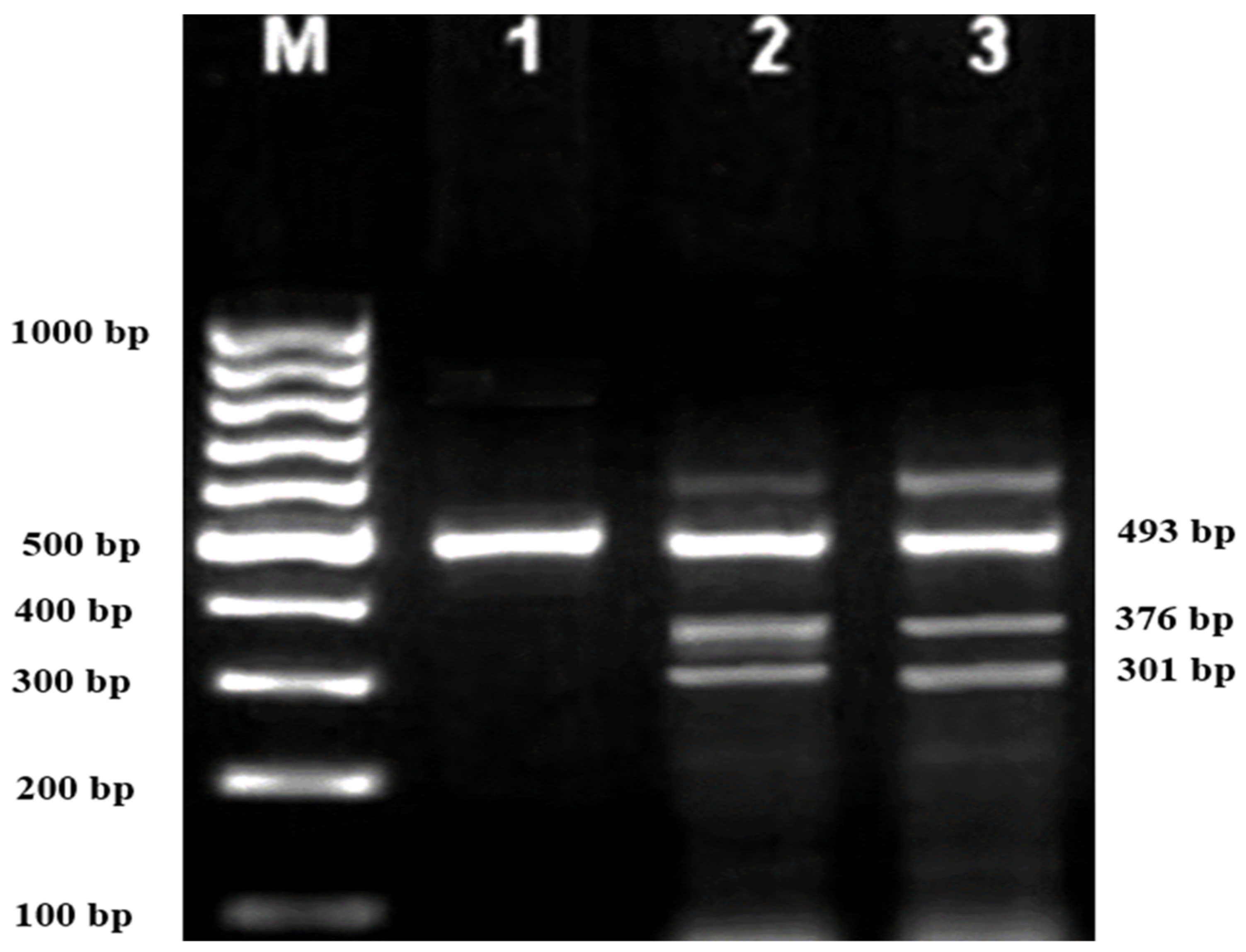HBB Gene Mutations and Their Pathological Impacts on HbE/β-Thalassaemia ...