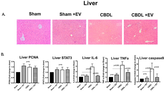 Vascular Extracellular Vesicles Indicate Severe Hepatopulmonary ...