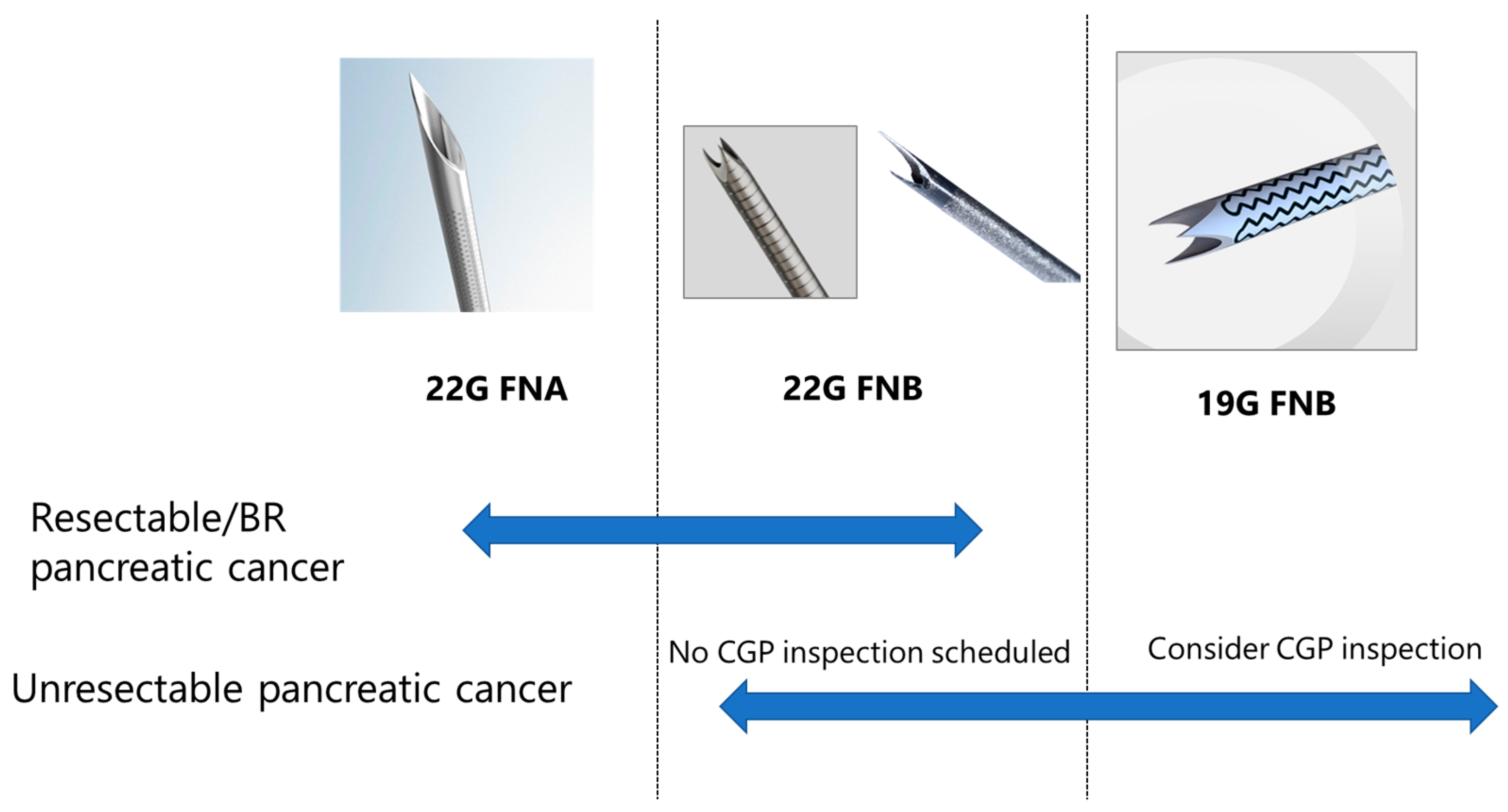 Endoscopic Ultrasound-Guided Tissue Acquisition of Pancreaticobiliary ...