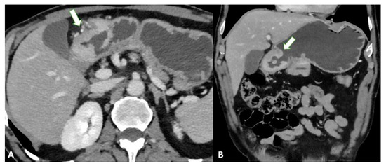 Imaging in Gastric Cancer: Current Practice and Future Perspectives