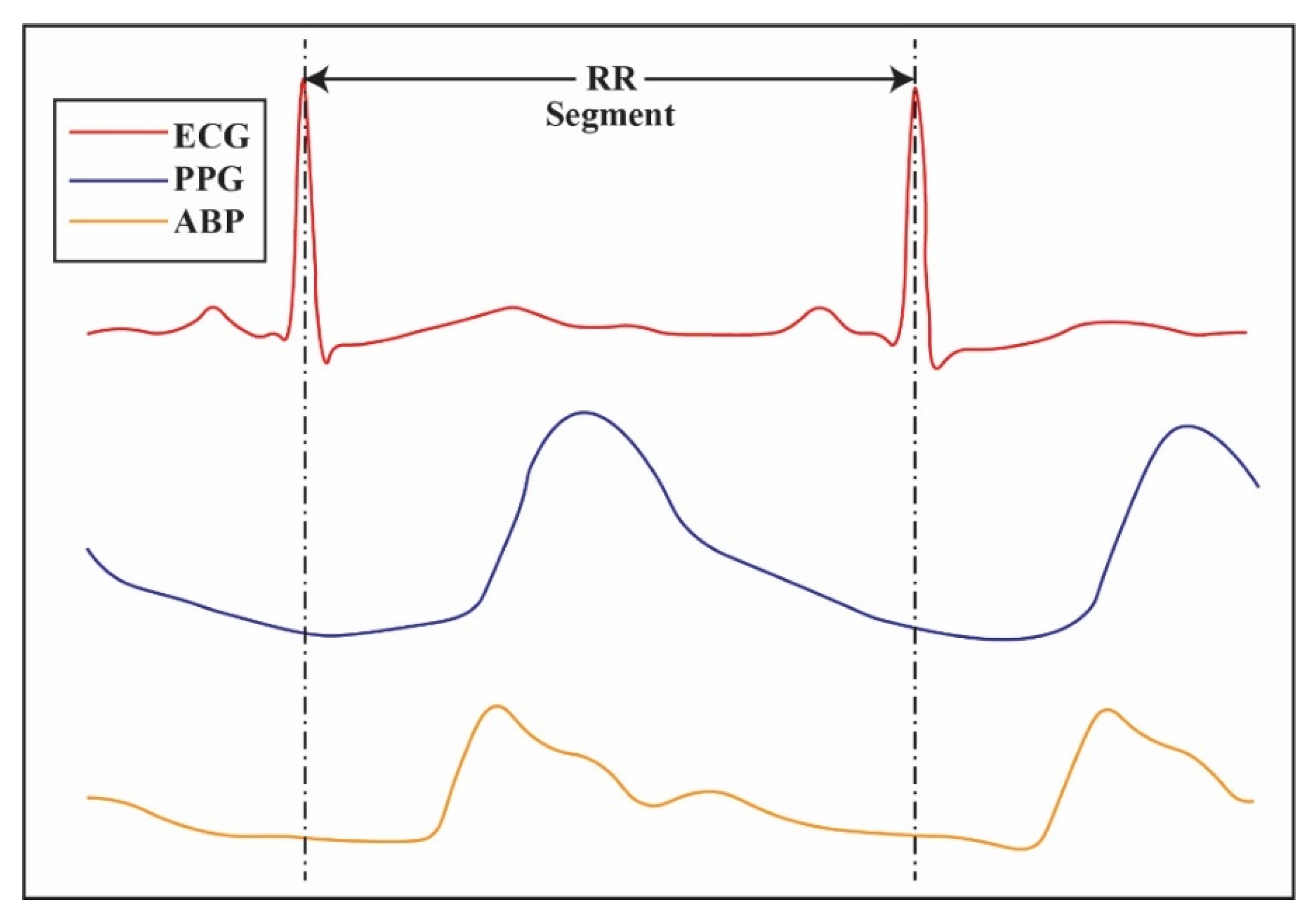 Diagnostics | Free Full-Text | A Novel Cuffless Blood Pressure ...