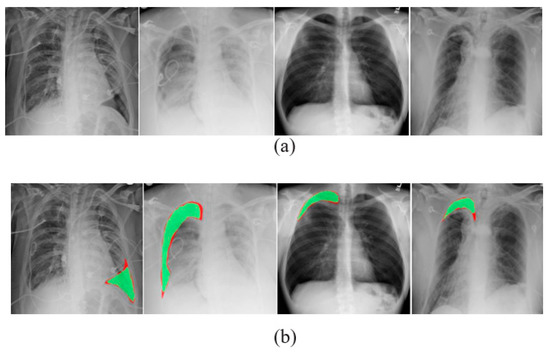 Diagnostics | Free Full-Text | “Quo Vadis Diagnosis”: Application of ...