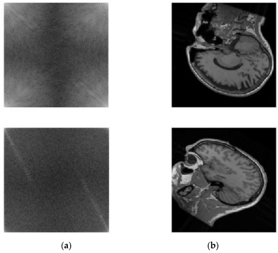 A Hybrid Residual Attention Convolutional Neural Network for Compressed ...