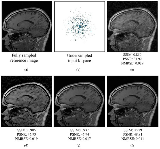 A Hybrid Residual Attention Convolutional Neural Network for Compressed ...