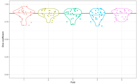 CNV-Net: Segmentation, Classification and Activity Score Measurement of ...