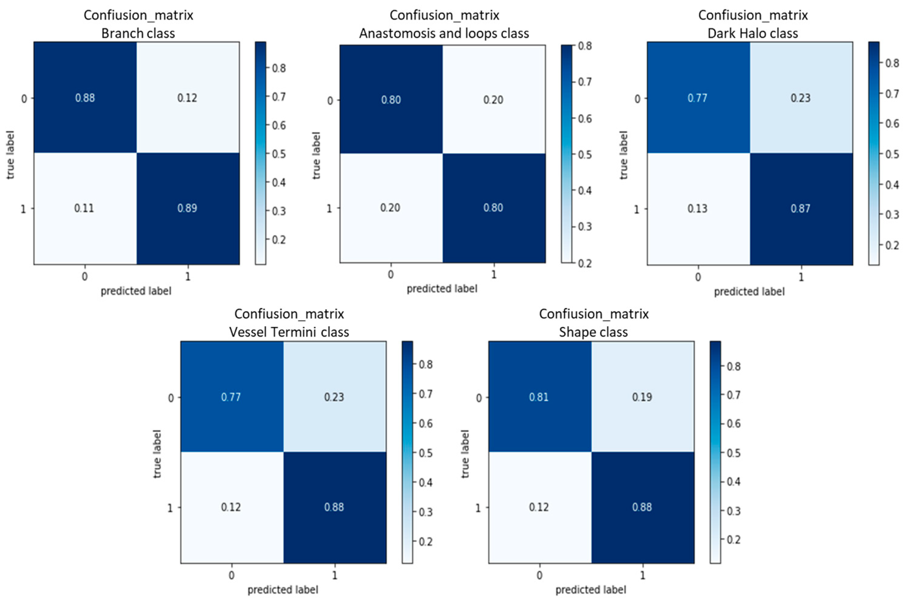 CNV-Net: Segmentation, Classification and Activity Score Measurement of Choroidal ...