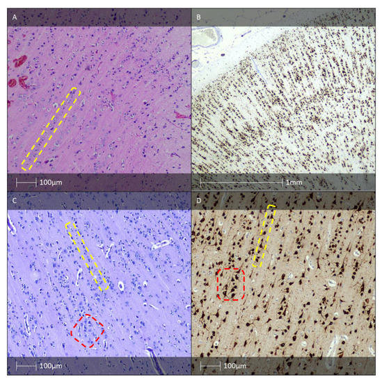 Diagnostics | Free Full-Text | Pathomorphological Diagnostic Criteria ...