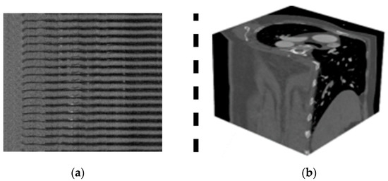 Developing a Deep-Learning-Based Coronary Artery Disease Detection ...