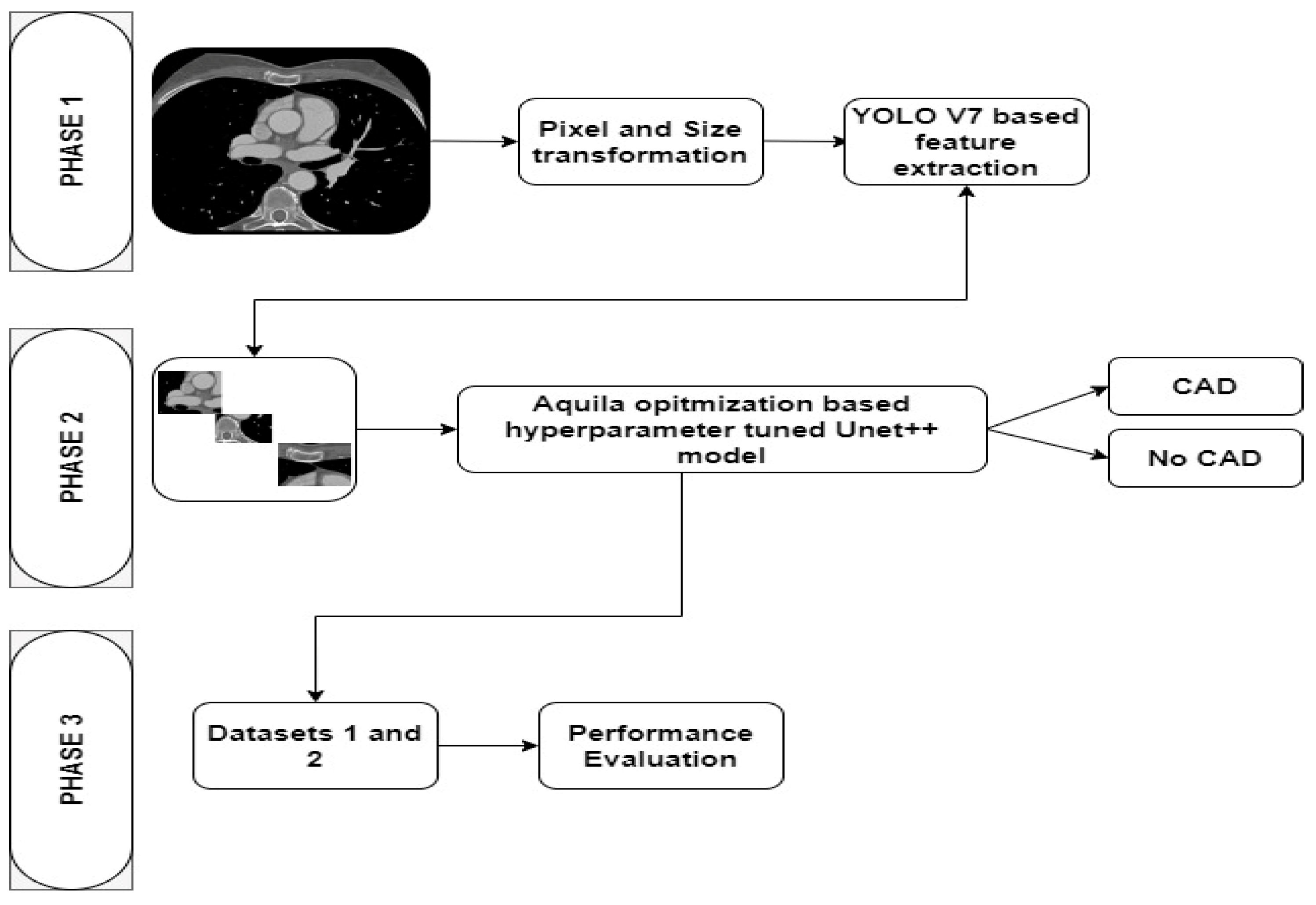 Developing a Deep-Learning-Based Coronary Artery Disease Detection ...
