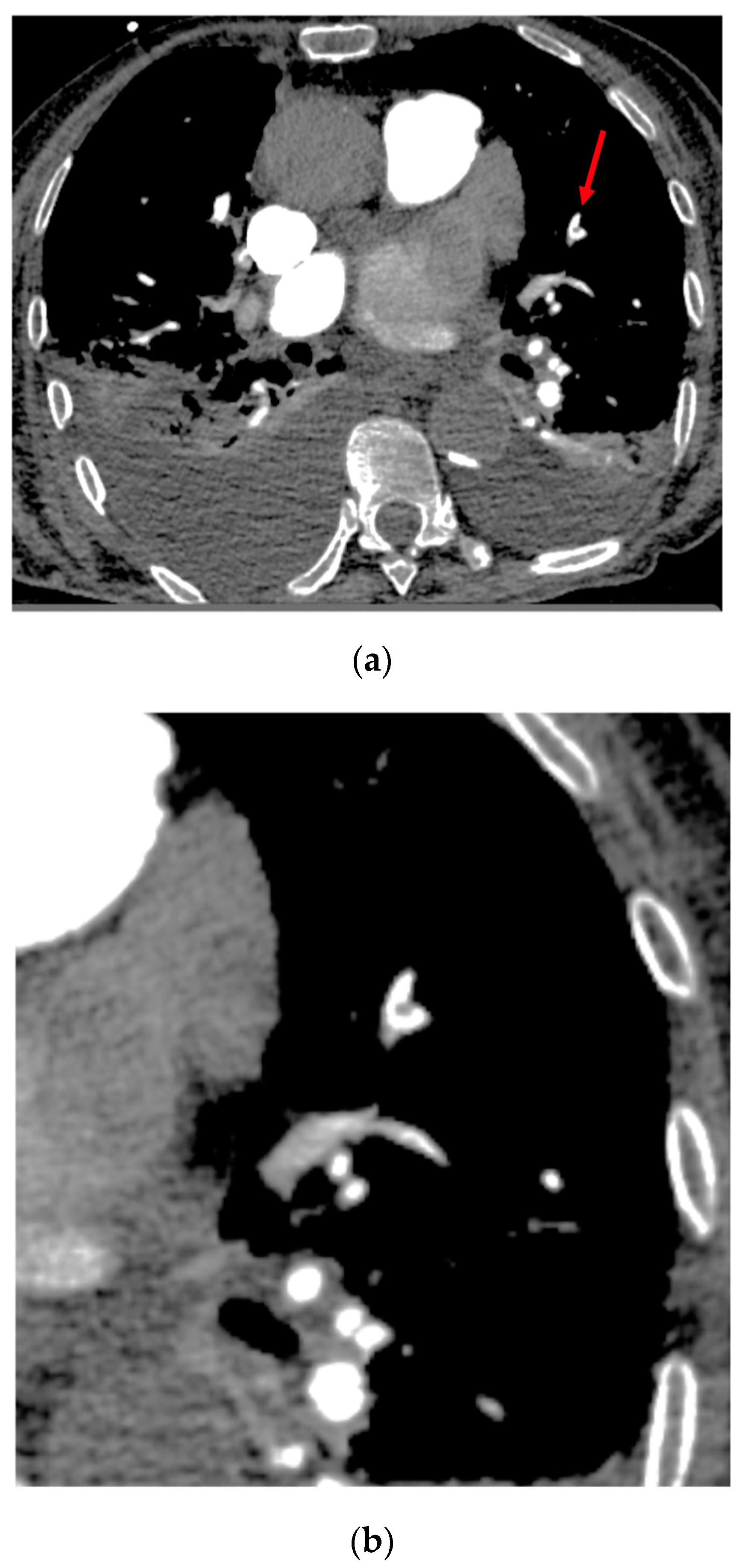 Diagnostics | Free Full-Text | Deep Learning-Based Algorithm for Automatic Detection of ...