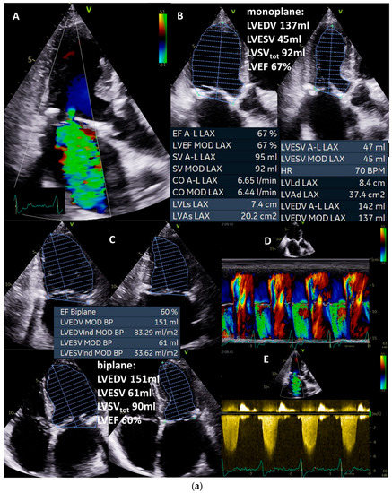 Diagnostics | Free Full-Text | Valid and Reproducible Quantitative ...