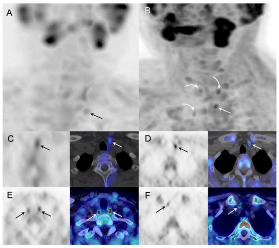 18F-Fluorocholine PET/CT Compared with Current Imaging Procedures for ...