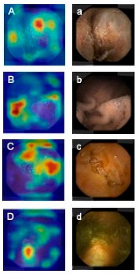 Automatic Classification of GI Organs in Wireless Capsule Endoscopy ...