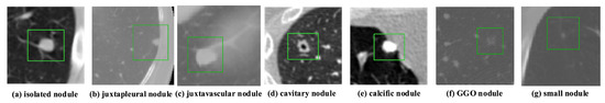 Diagnostics | Free Full-Text | A Bi-FPN-Based Encoder–Decoder Model for Lung Nodule Image ...