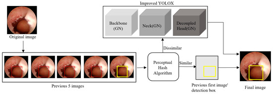 Diagnostics | Free Full-Text | Automated Detection of Endometrial Polyps from Hysteroscopic ...