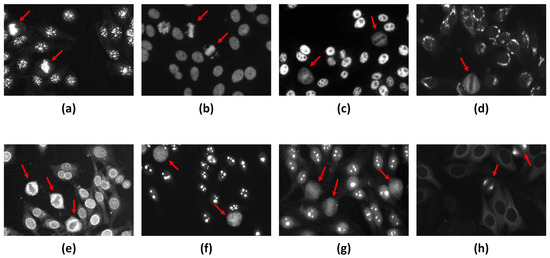 Deep Active Learning for Automatic Mitotic Cell Detection on HEp-2 Specimen Medical Images