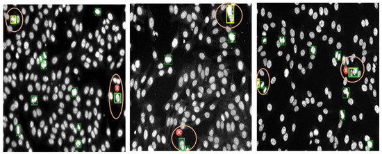 Deep Active Learning for Automatic Mitotic Cell Detection on HEp-2 Specimen Medical Images