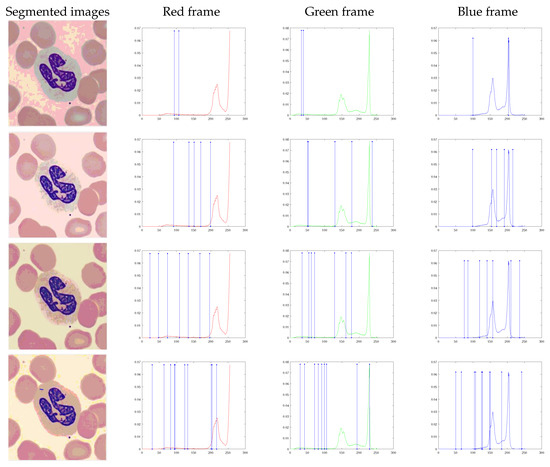 An Improved Search and Rescue Algorithm for Global Optimization and Blood Cell Image Segmentation