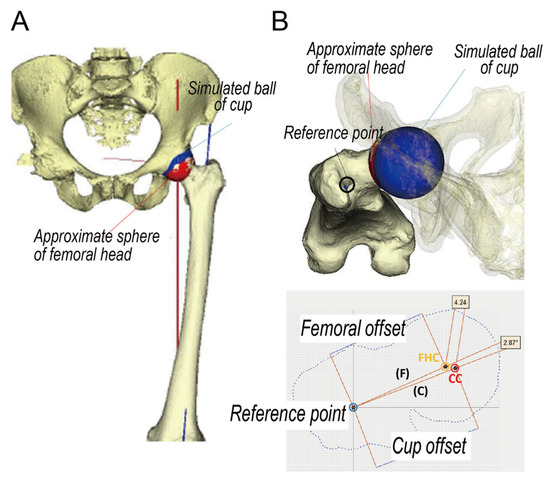 Diagnostics | Free Full-Text | Anatomical and Simulation Studies Based ...