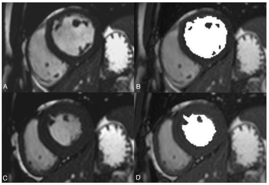 Diagnostics | Free Full-Text | Cardiac MRI: An Alternative Method to ...