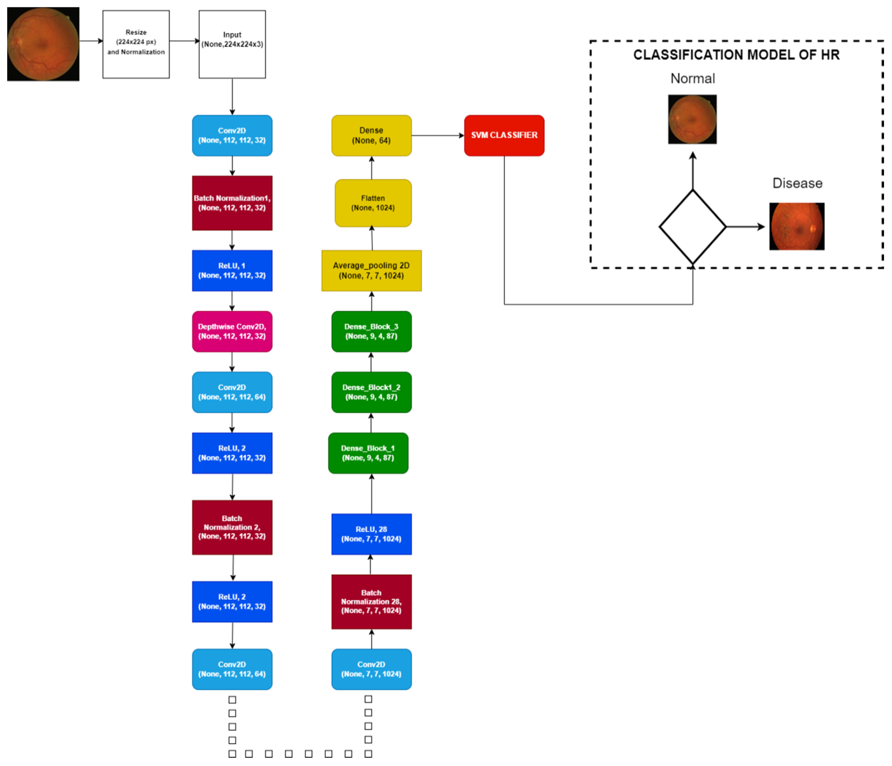 Mobile-HR: An Ophthalmologic-Based Classification System for Diagnosis ...