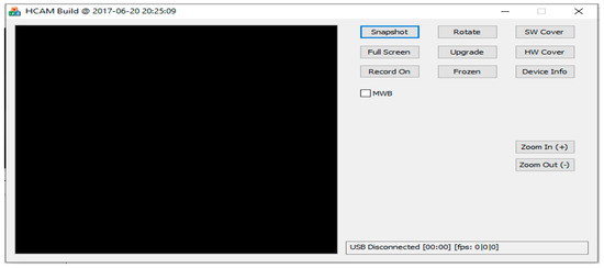 Intelligent Wireless Capsule Endoscopy for the Diagnosis of ...