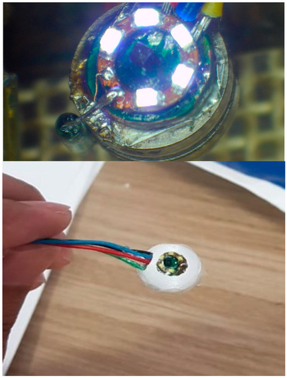 Intelligent Wireless Capsule Endoscopy for the Diagnosis of ...