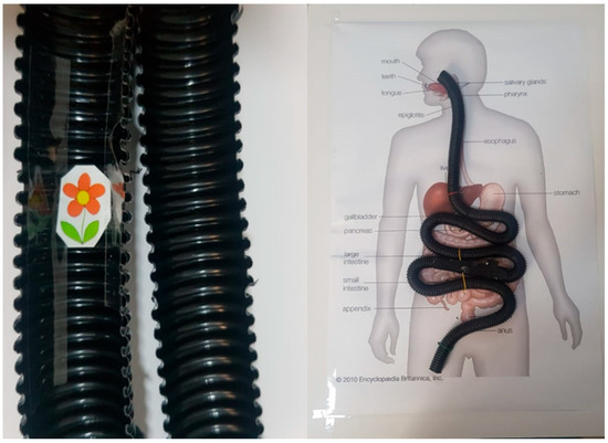 Intelligent Wireless Capsule Endoscopy for the Diagnosis of ...