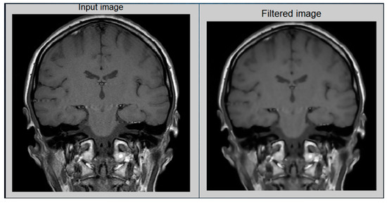 Diagnostics | Free Full-Text | Recognizing Brain Tumors Using Adaptive ...
