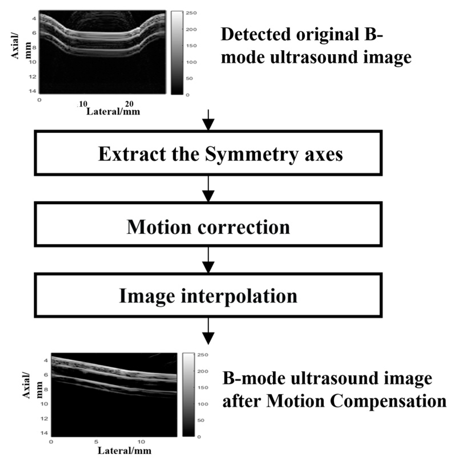 A Method for High-Frequency Mechanical Scanning Ultrasonic Flow Imaging ...