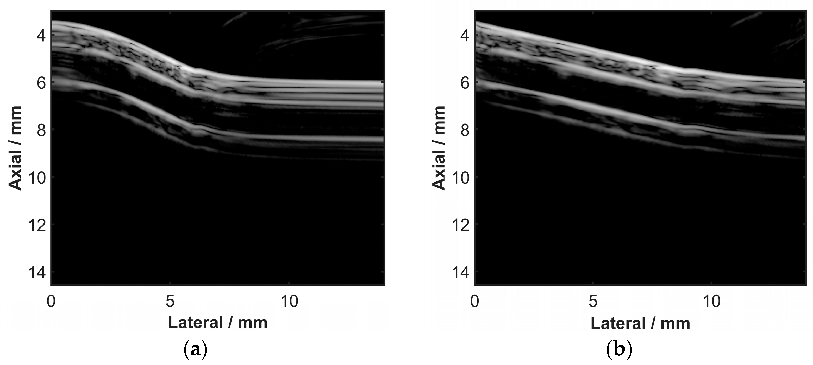 A Method for High-Frequency Mechanical Scanning Ultrasonic Flow Imaging ...