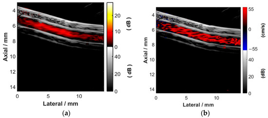 Diagnostics | Free Full-Text | A Method for High-Frequency Mechanical ...