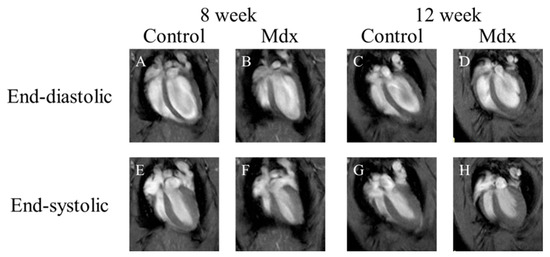 Evaluation of Cardiac Function in Young Mdx Mice Using MRI with Feature ...