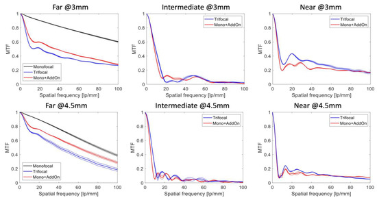 Comparison of a Presbyopia-Correcting Supplementary Intraocular Lens ...