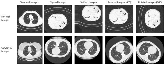 Diagnostics | Free Full-Text | COVID-19 Diagnosis in Computerized ...