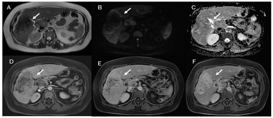 Diagnostics | Free Full-Text | Update on the Applications of Radiomics ...