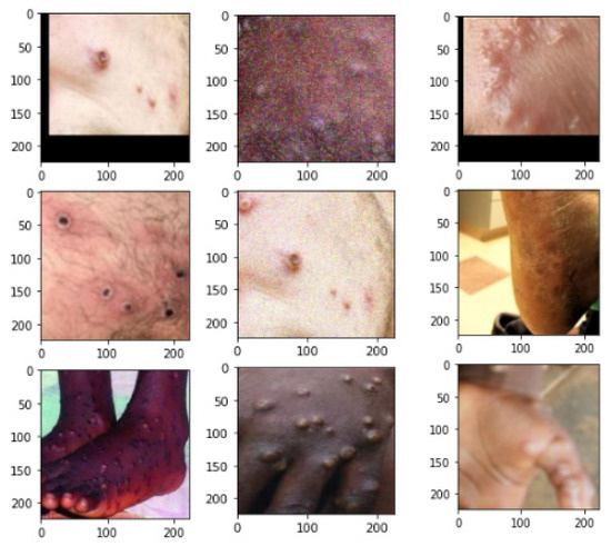 Human Pathogenic Monkeypox Disease Recognition Using Q-Learning Approach