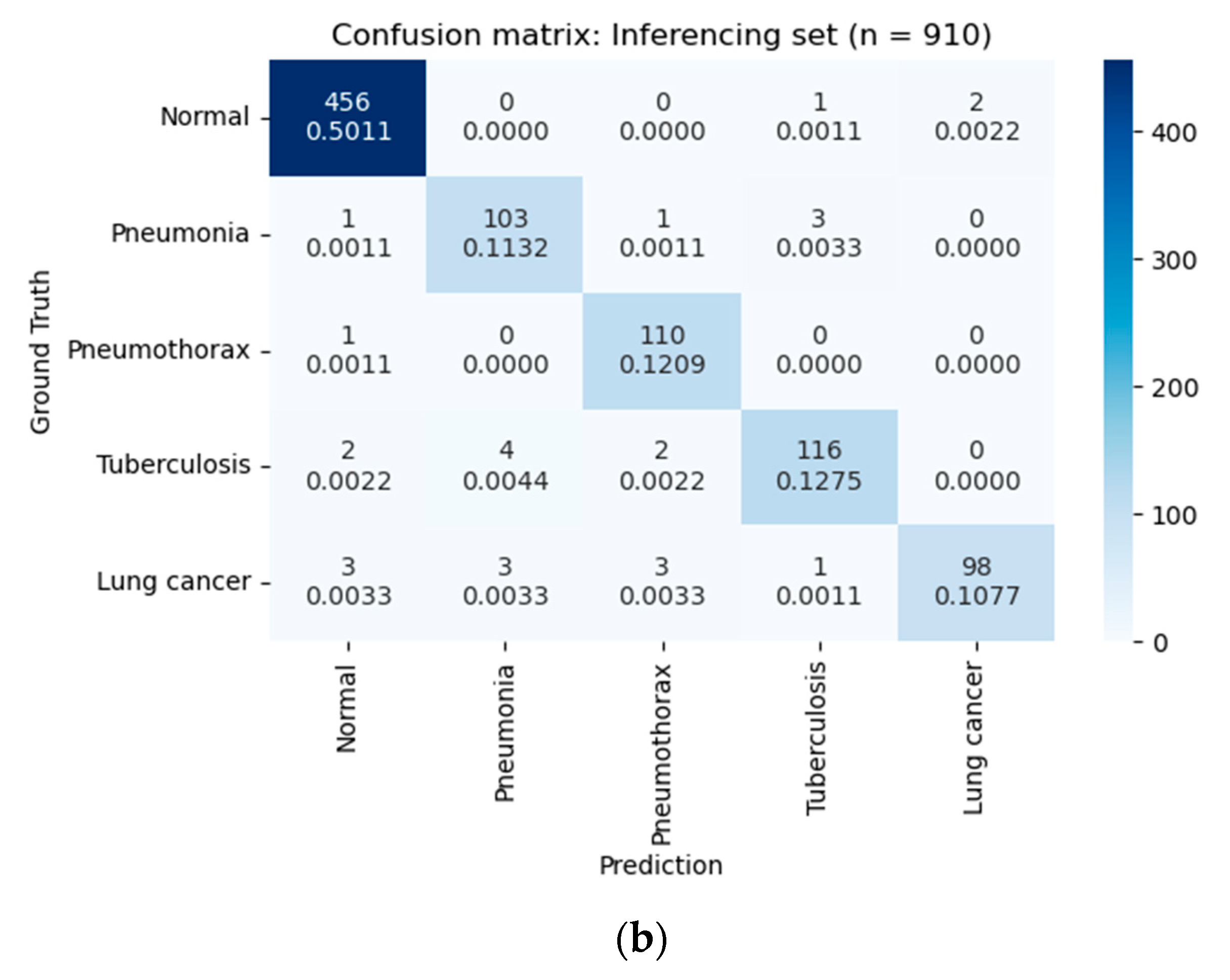OView-AI Supporter for Classifying Pneumonia, Pneumothorax, Tuberculosis, Lung Cancer Chest X ...