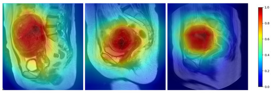 An Instance Segmentation Model Based on Deep Learning for Intelligent ...