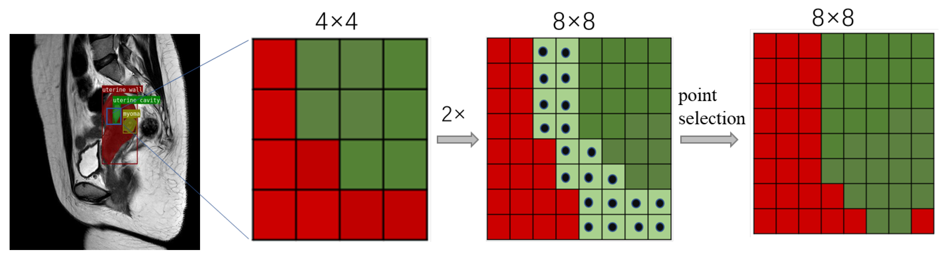 An Instance Segmentation Model Based on Deep Learning for Intelligent Diagnosis of Uterine ...
