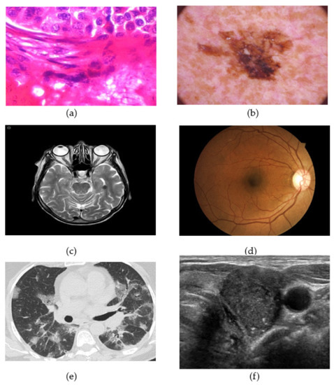 Federated Learning for Medical Image Analysis with Deep Neural Networks